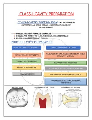 Class 1 cavity preparation | DOCX