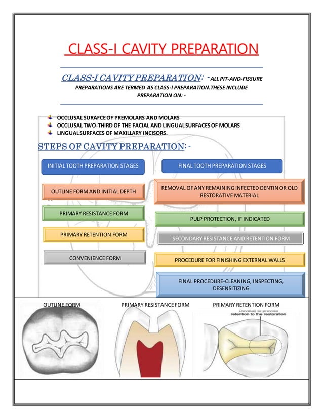 Class 1 cavity preparation | DOCX
