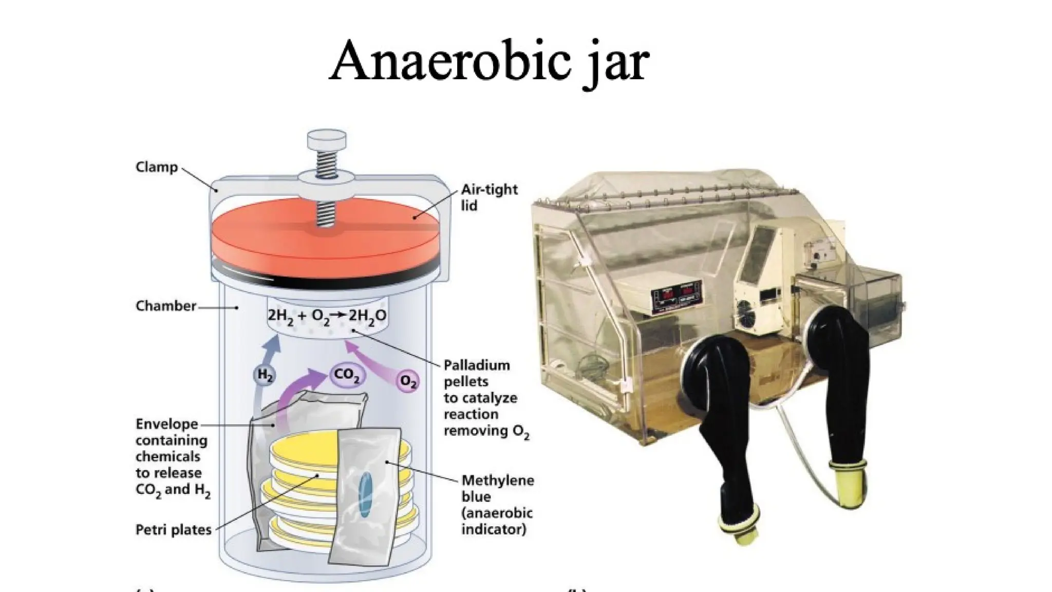 Anaerobic bacteria, Introduction, diagnosis and management .pptx ...