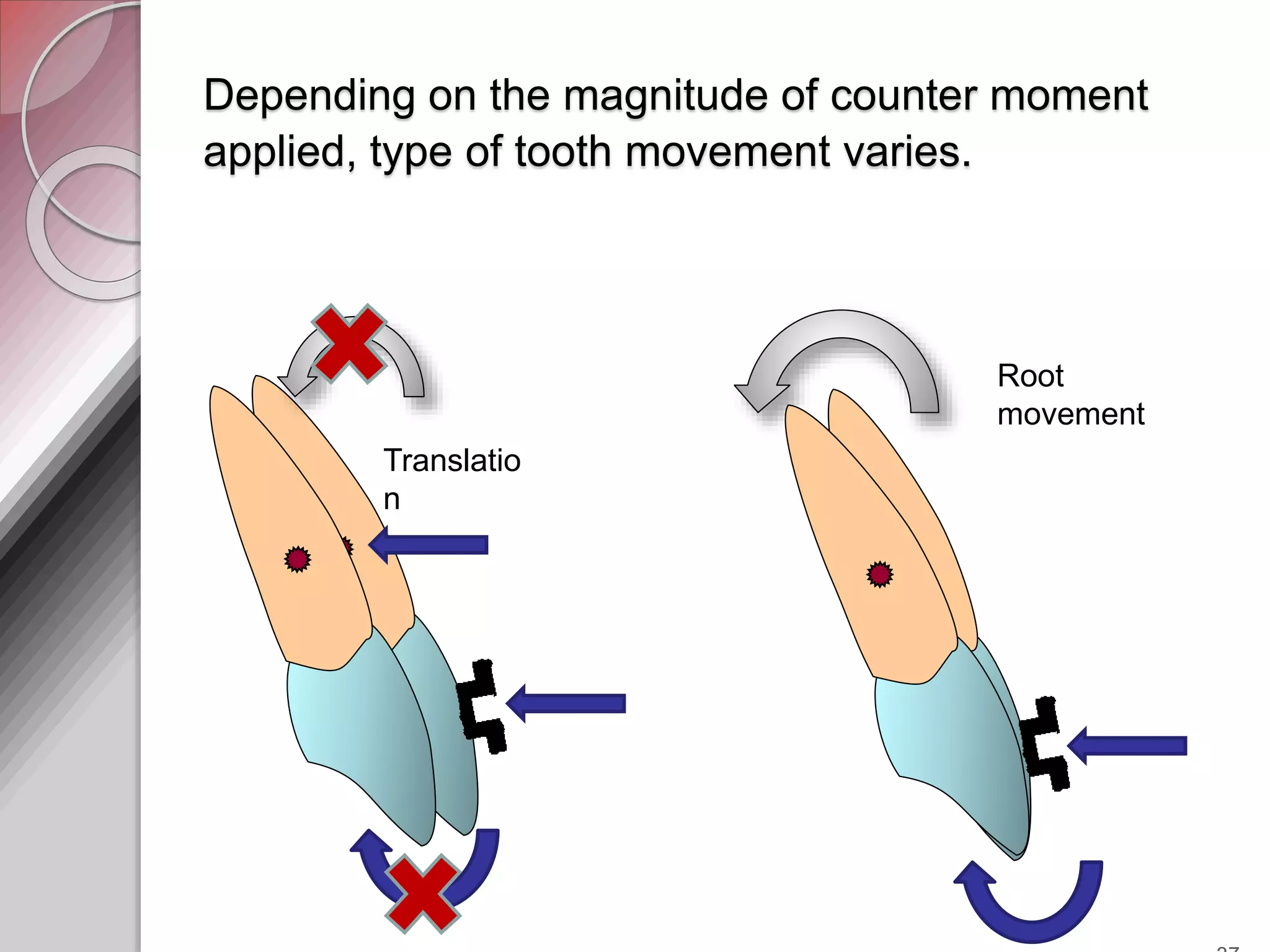 Biomechanics in Orthodontics | PPTX