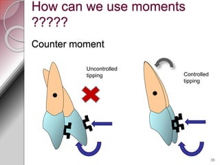 Biomechanics in Orthodontics | PPTX