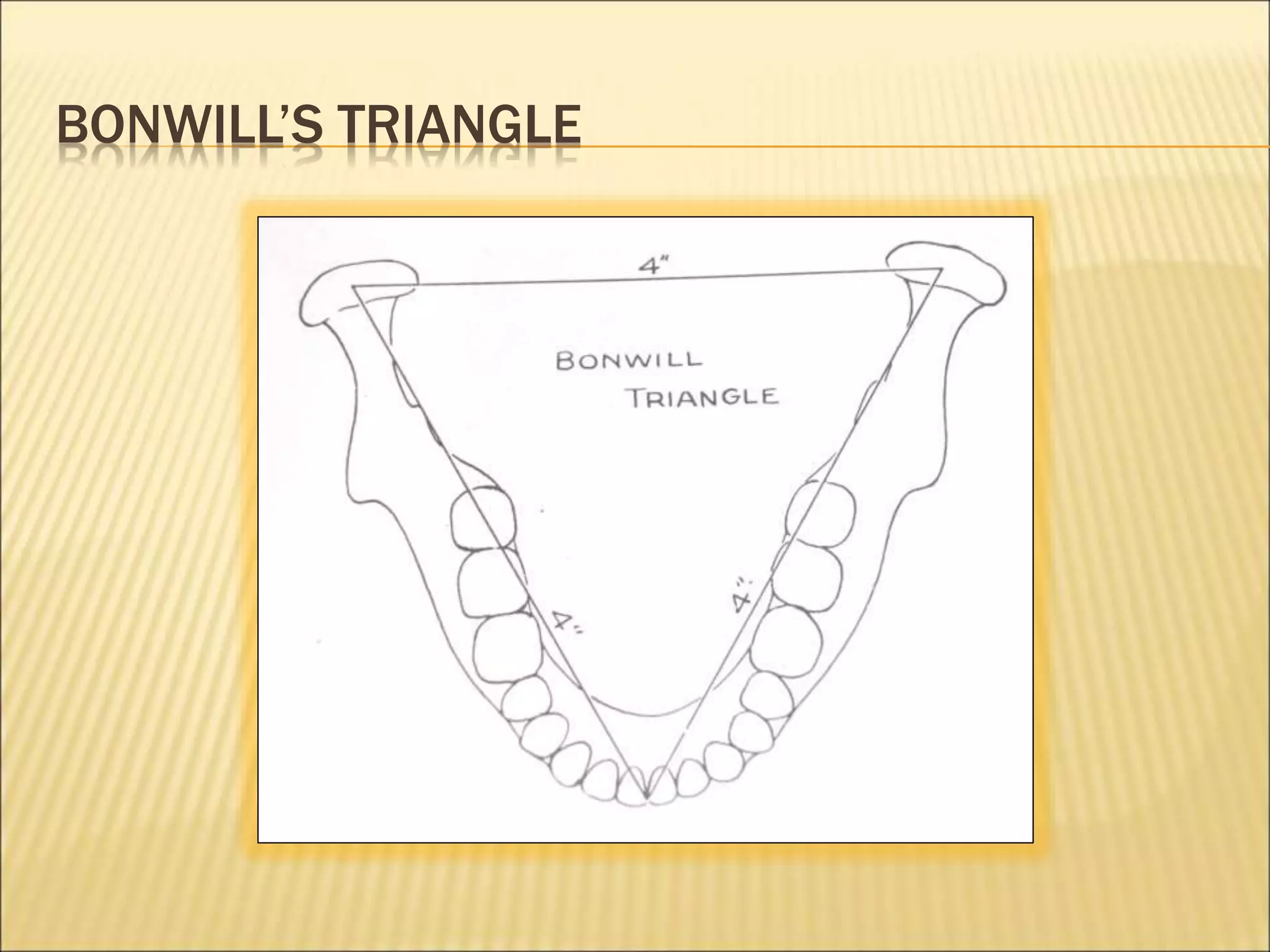 Class-Concept of occlusion O.ppt
