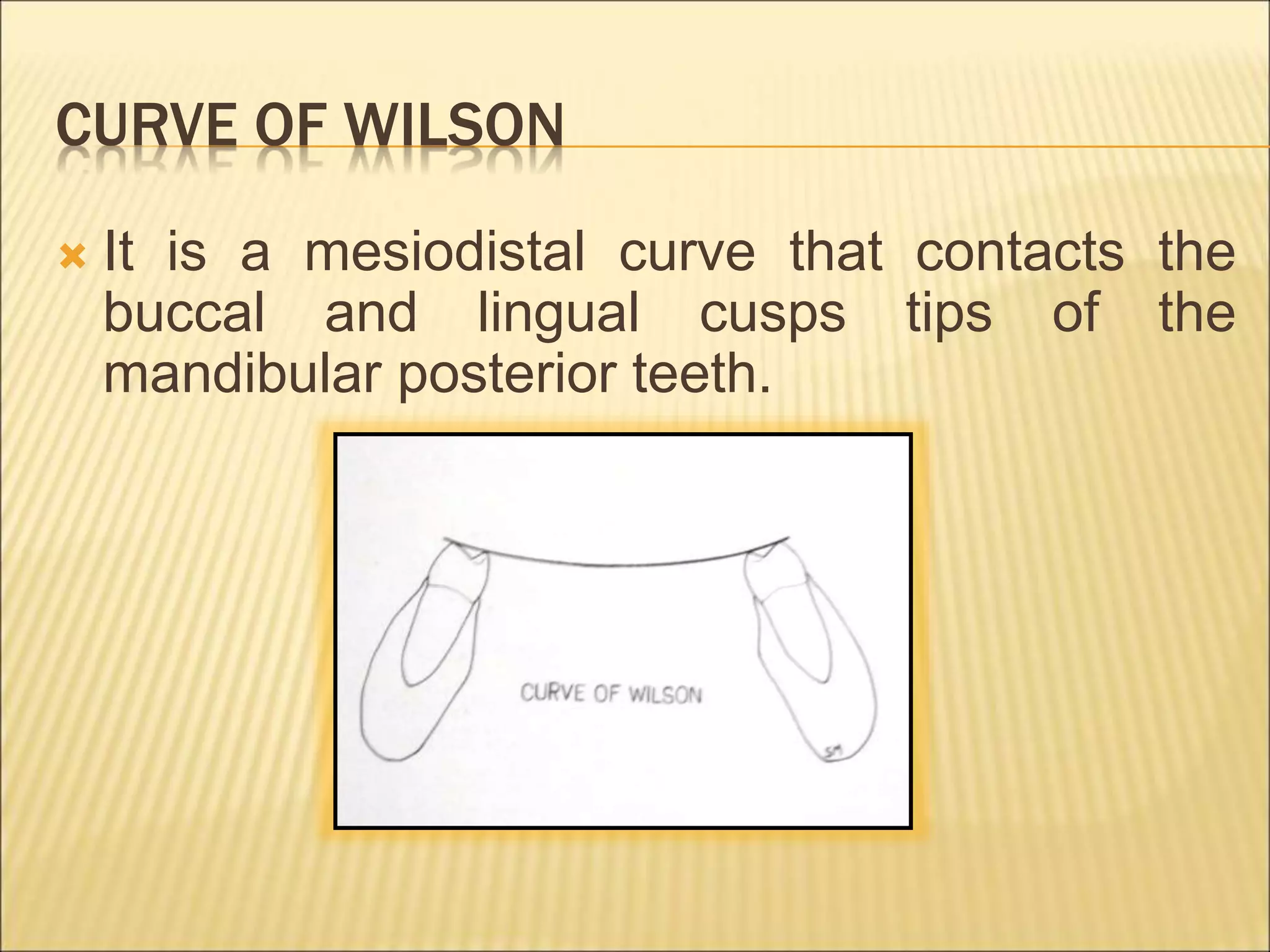Class-Concept of occlusion O.ppt