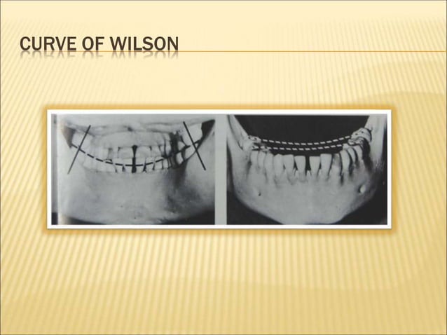 Class-Concept of occlusion O.ppt | Dental Health | Diseases and Conditions