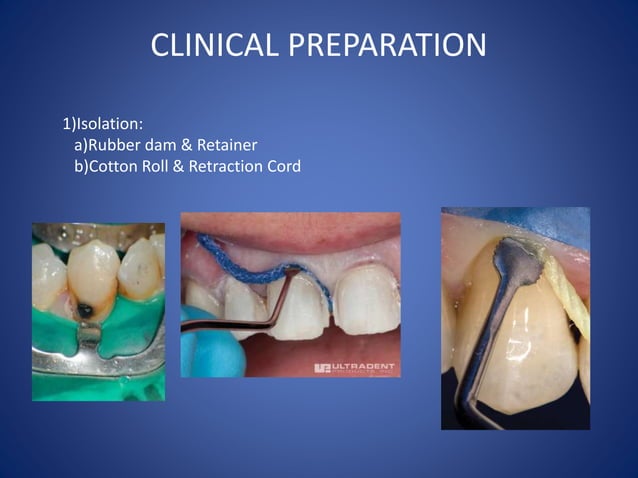 Class v-restoration - Operative | PPTX