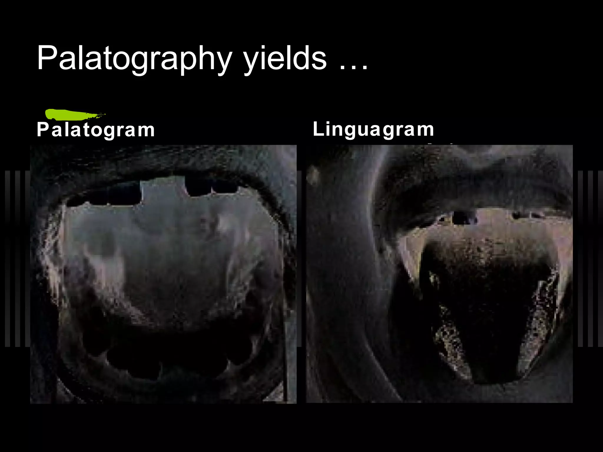 Class 08 emerson_phonetics_fall2014_articulation_vowels_consonants | PPT