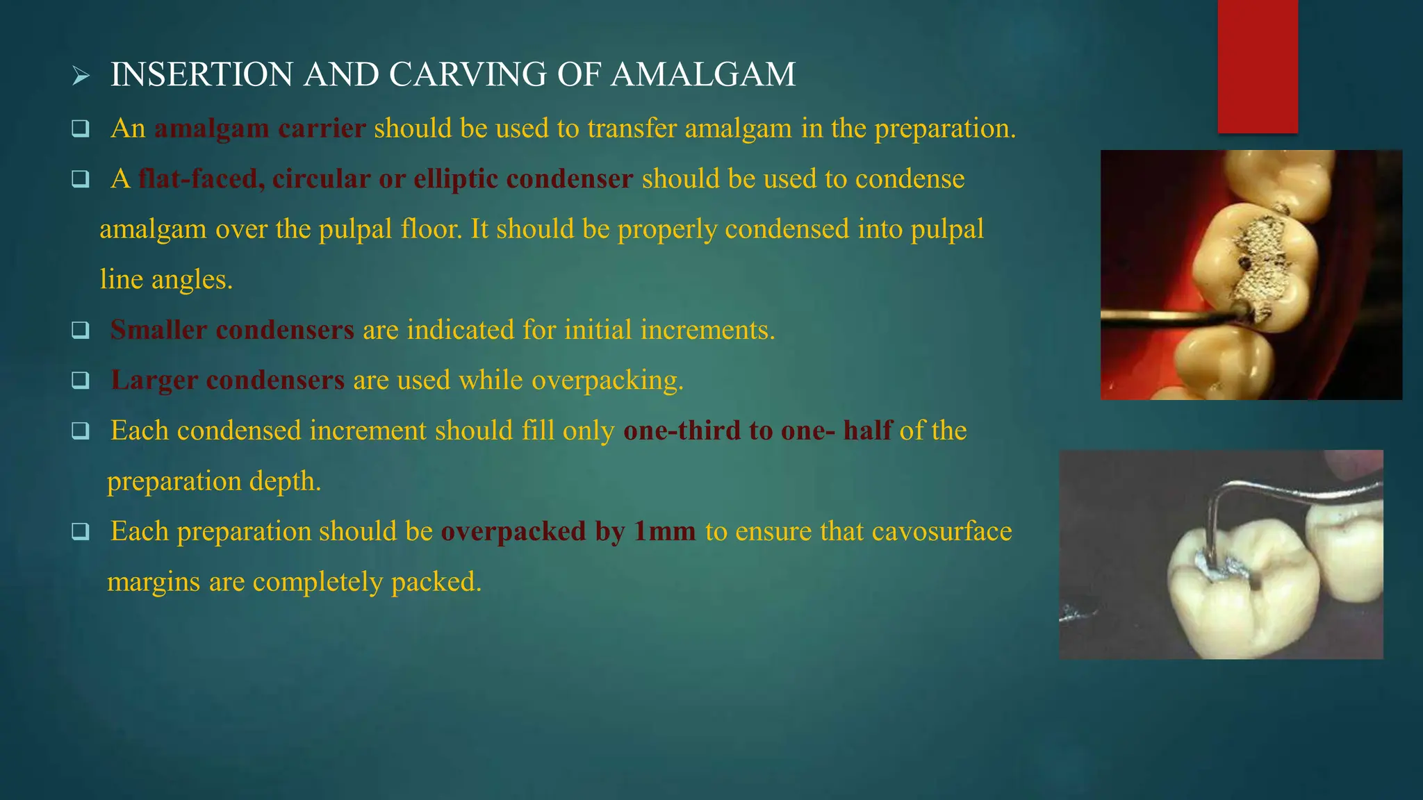 Class 1 and 2 amalgam tooth preparation. | PDF