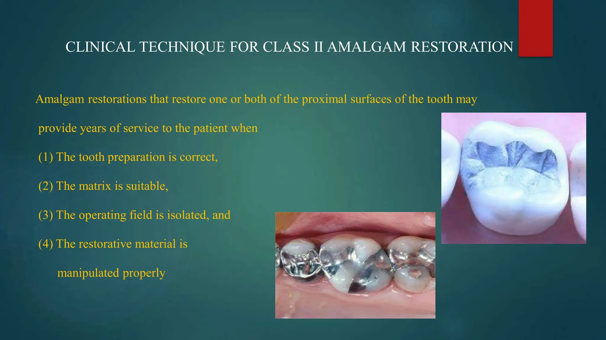 Class 1 and 2 amalgam tooth preparation. | PDF