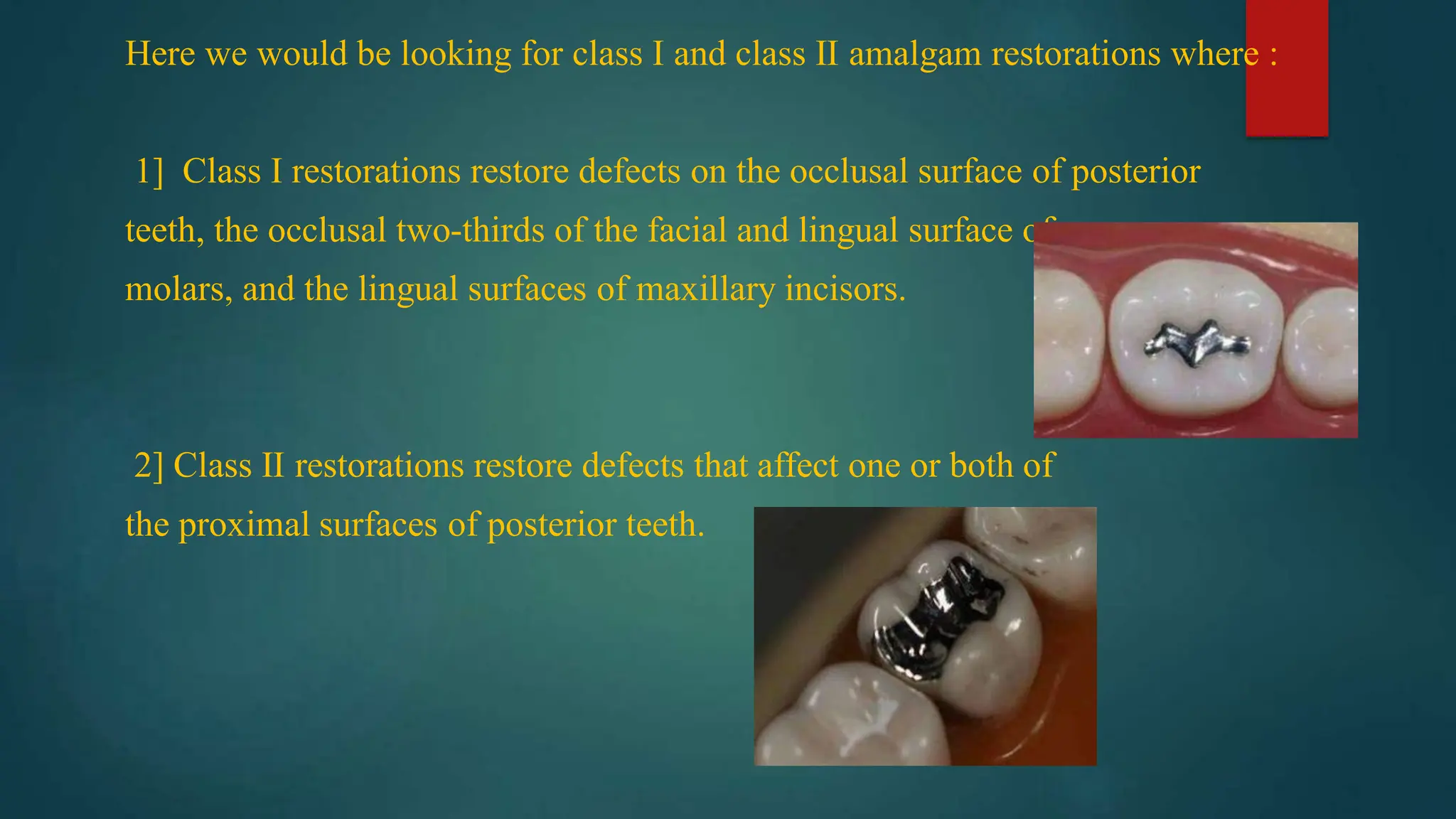 Class 1 and 2 amalgam tooth preparation. | PDF