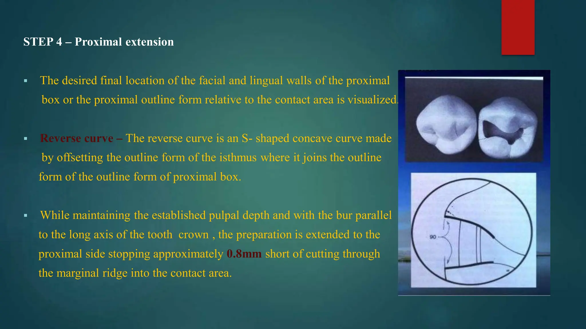 Class 1 and 2 amalgam tooth preparation. | PDF