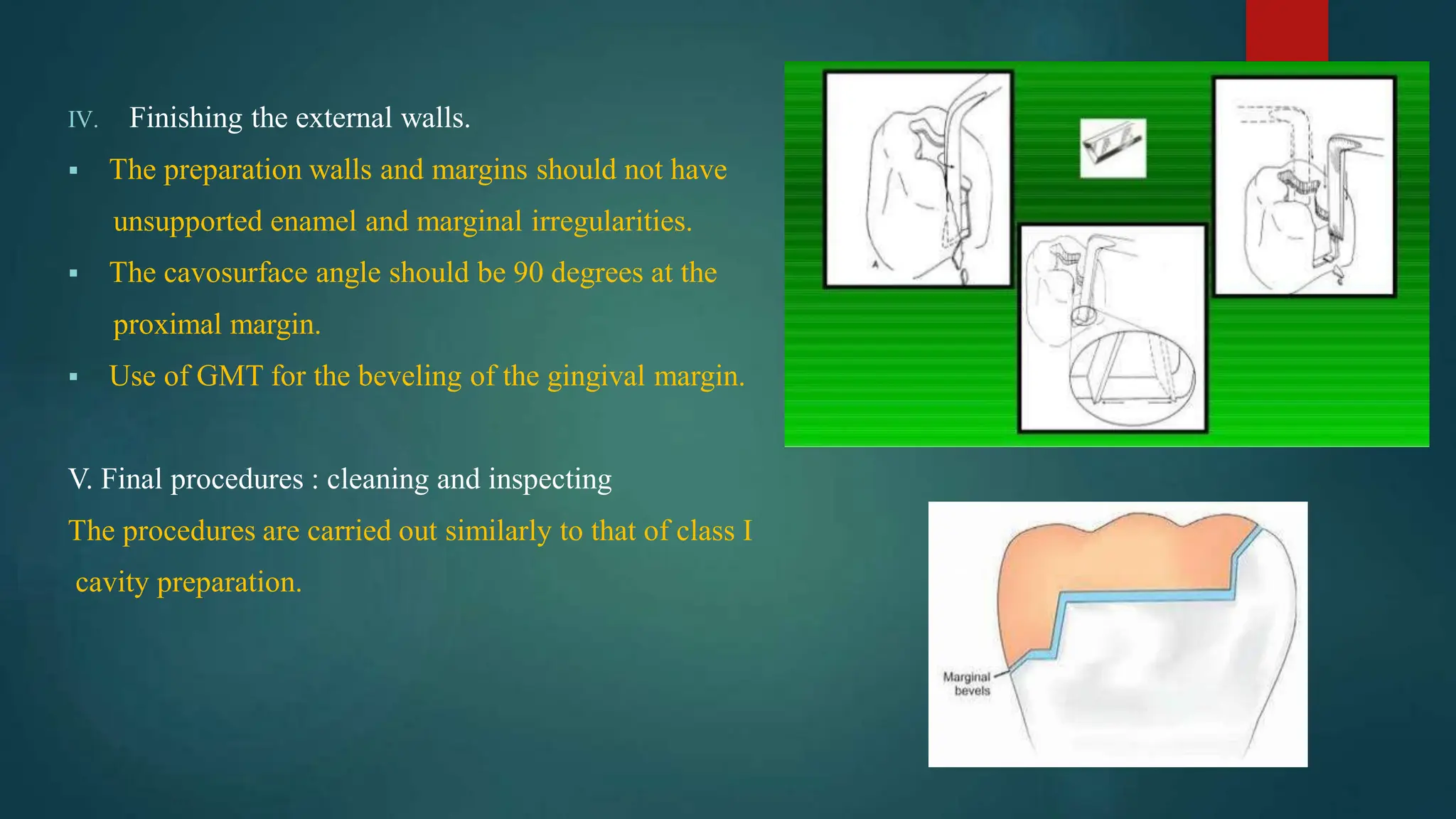 Class 1 and 2 amalgam tooth preparation. | PDF