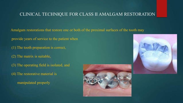 Class 1 and 2 amalgam tooth preparation. | PDF