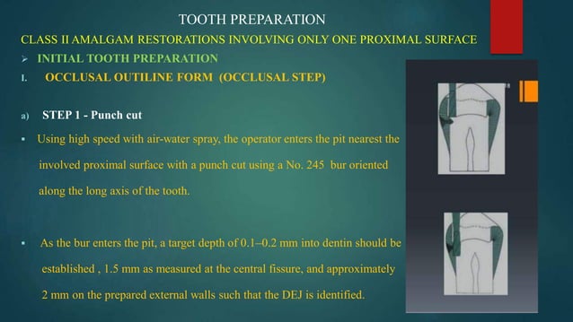 Class 1 and 2 amalgam tooth preparation. | PDF