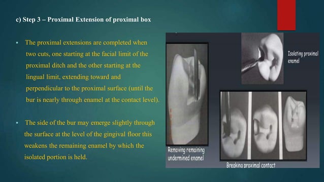 Class 1 and 2 amalgam tooth preparation. | PDF