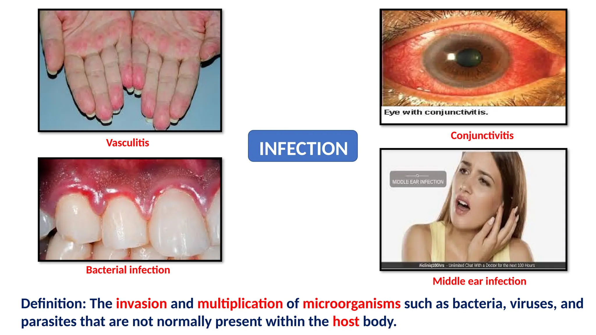 Infection- Classification, Types, Diagnosis, Features | PPTX ...