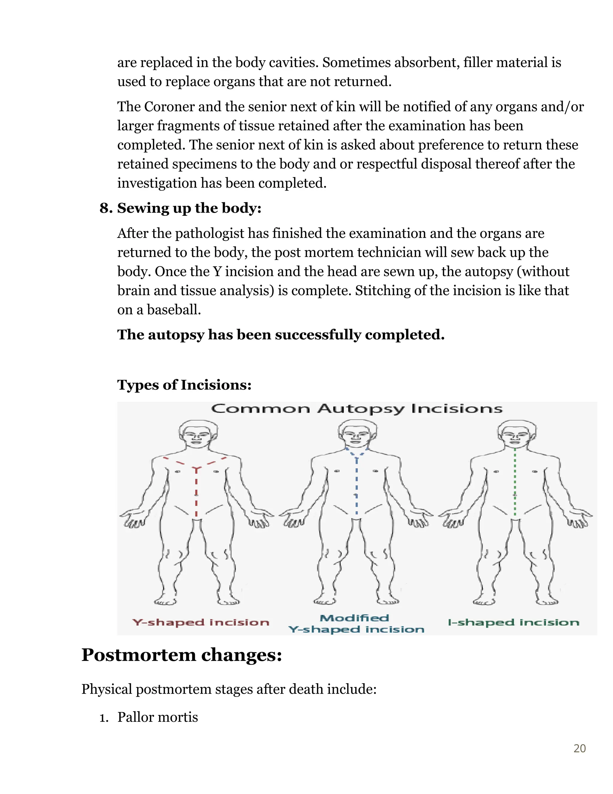 Class 11 and 12 Investigatory project on Autopsy | DOCX