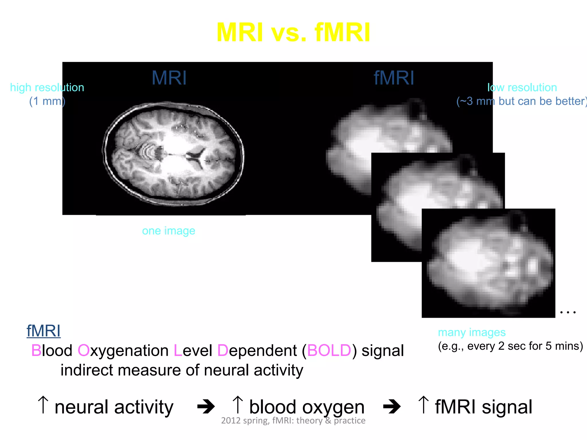 Class 1 f_mri_intro | PPT