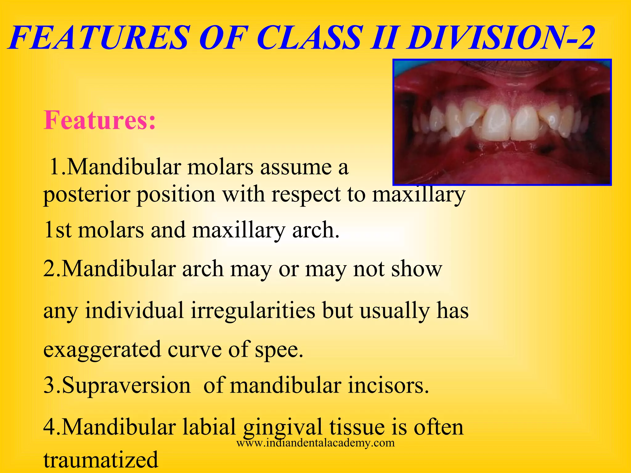 Class 2. div 2 | PPT