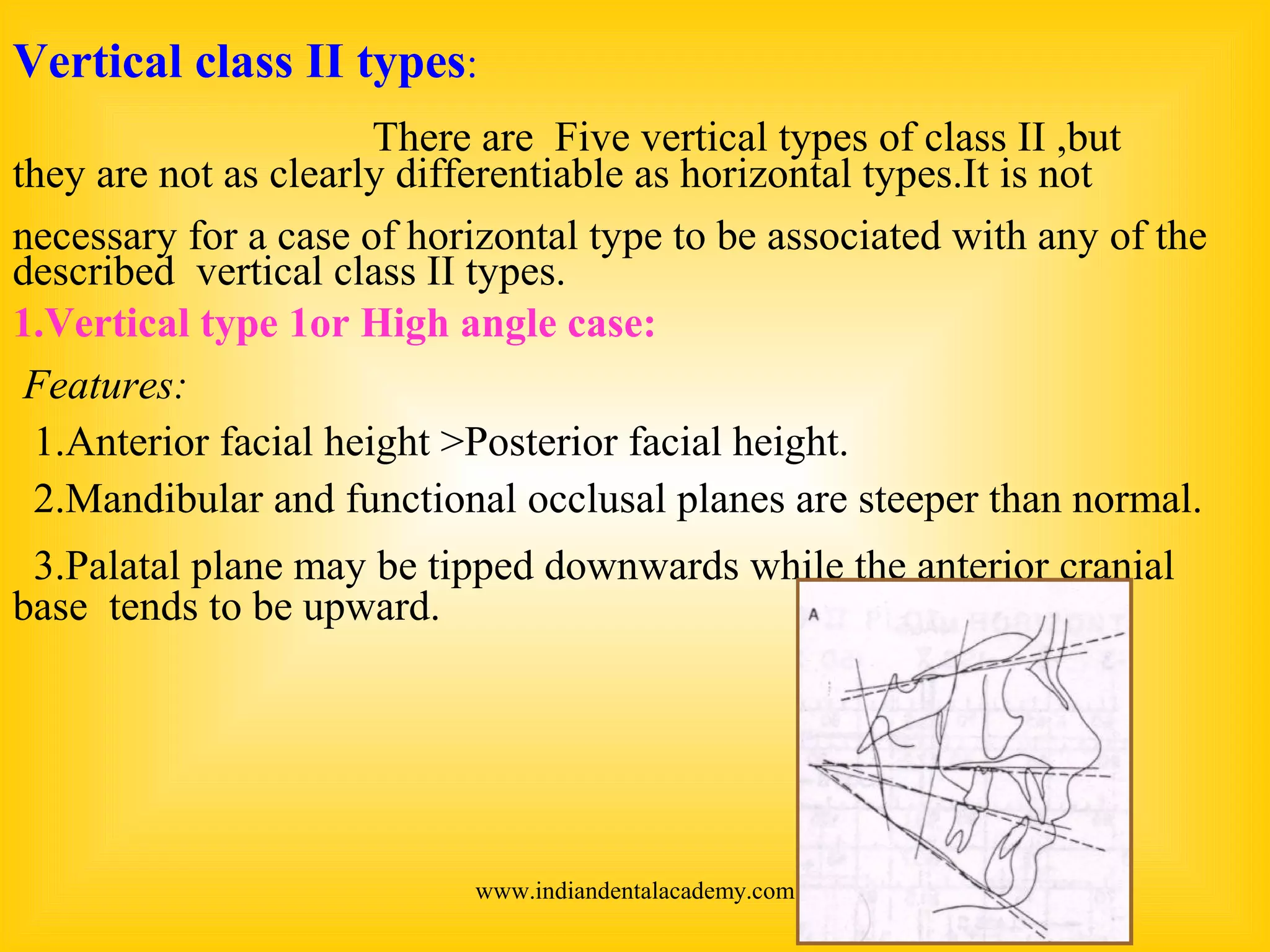 Class 2. div 2 | PPT