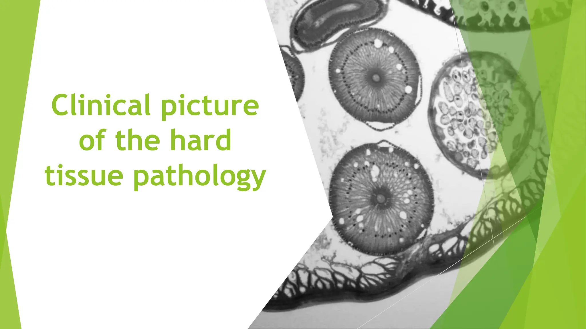 Etiology, clinical picture and treatment of pathology of hard tissues ...