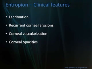 Lids and Adnexa Class 2 Part B - Lid malpositions | PPTX