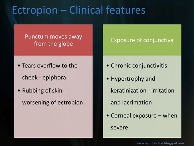 Lids and Adnexa Class 2 Part B - Lid malpositions | PPTX