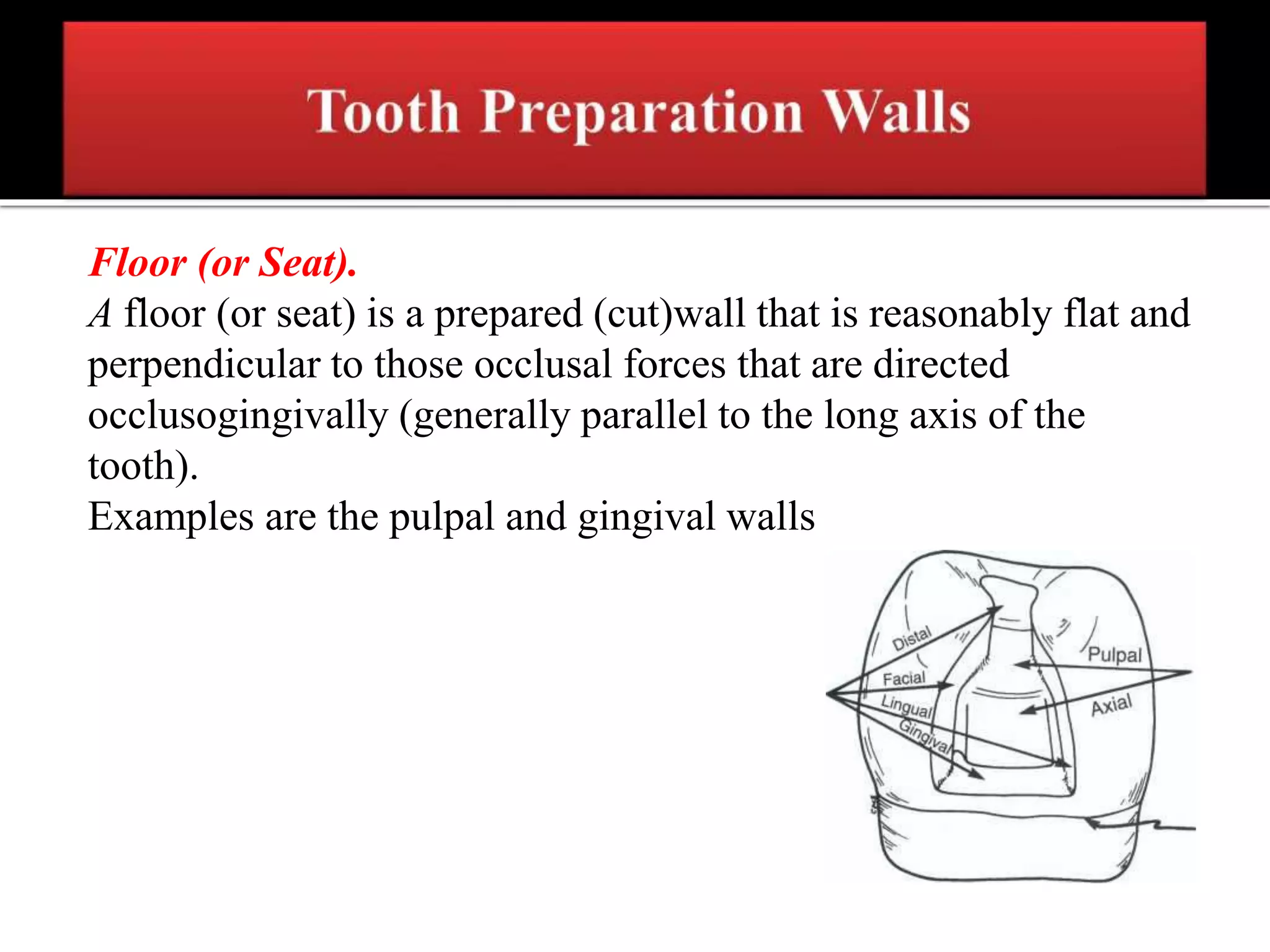 Class 2 amalgam restoration | PPTX