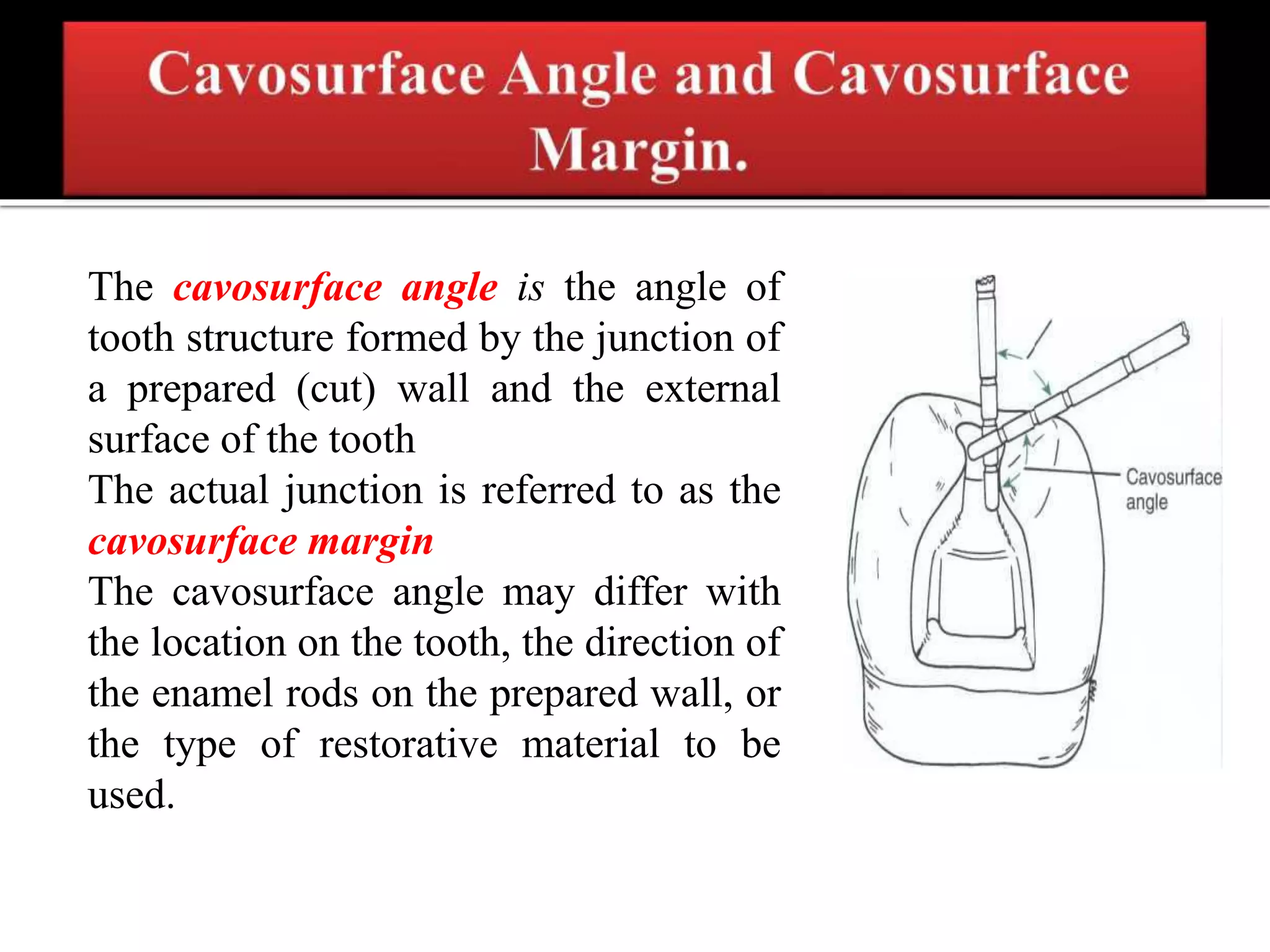 Class 2 amalgam restoration | PPTX