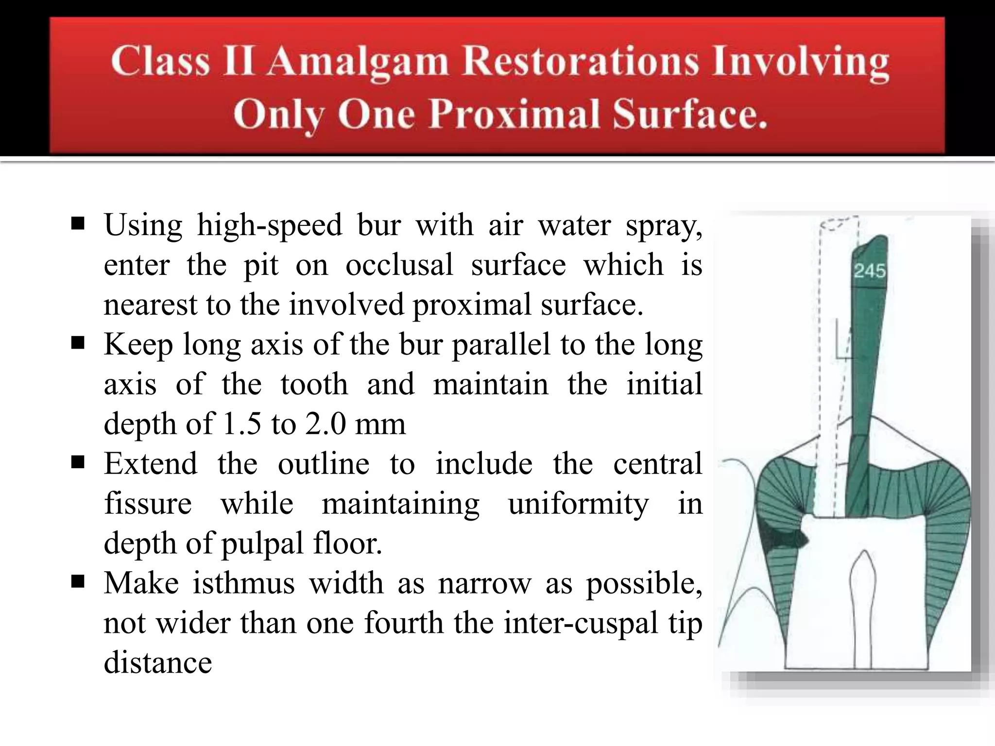 Class 2 amalgam restoration | PPTX