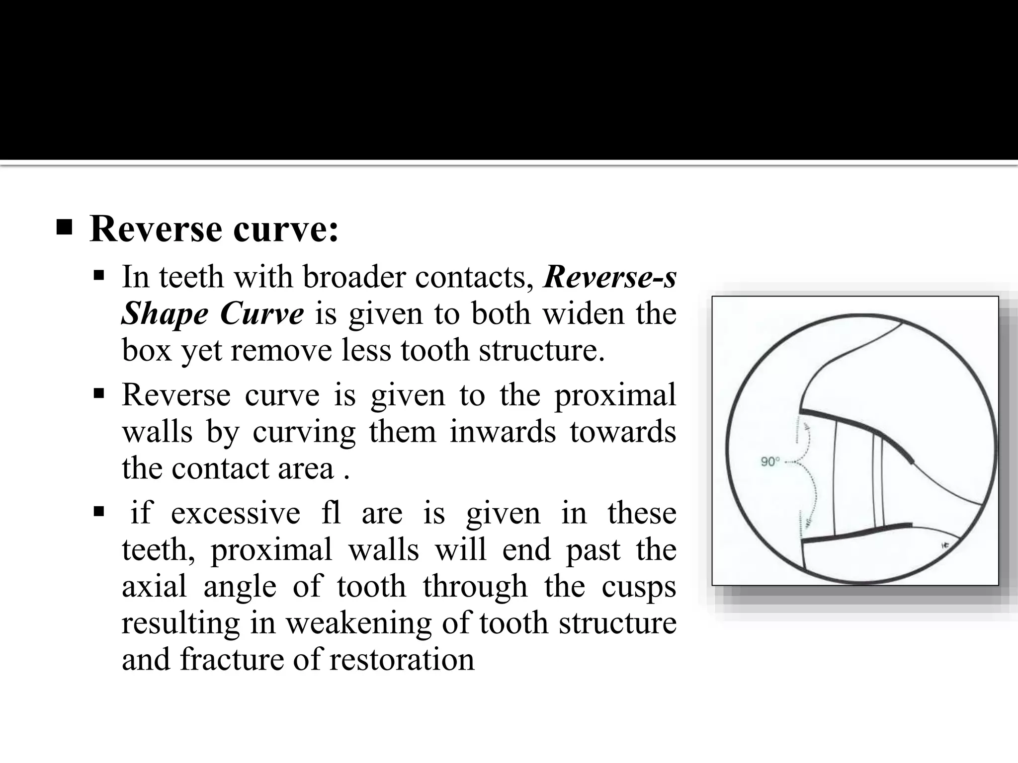 Class 2 amalgam restoration | PPTX