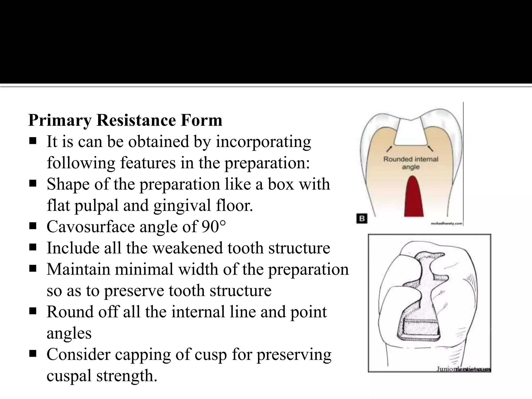 Class 2 amalgam restoration | PPTX