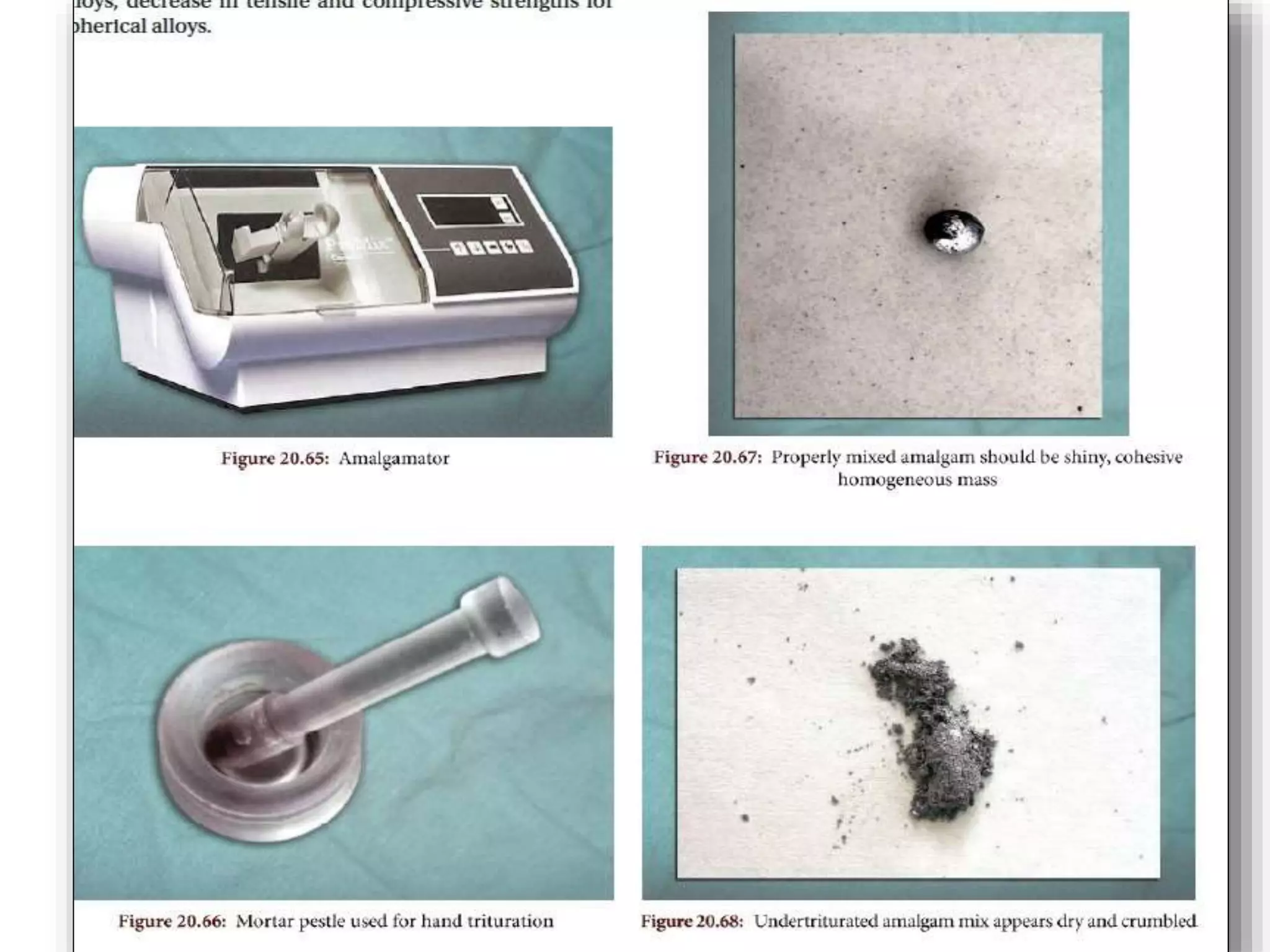 Class 2 amalgam restoration | PPTX