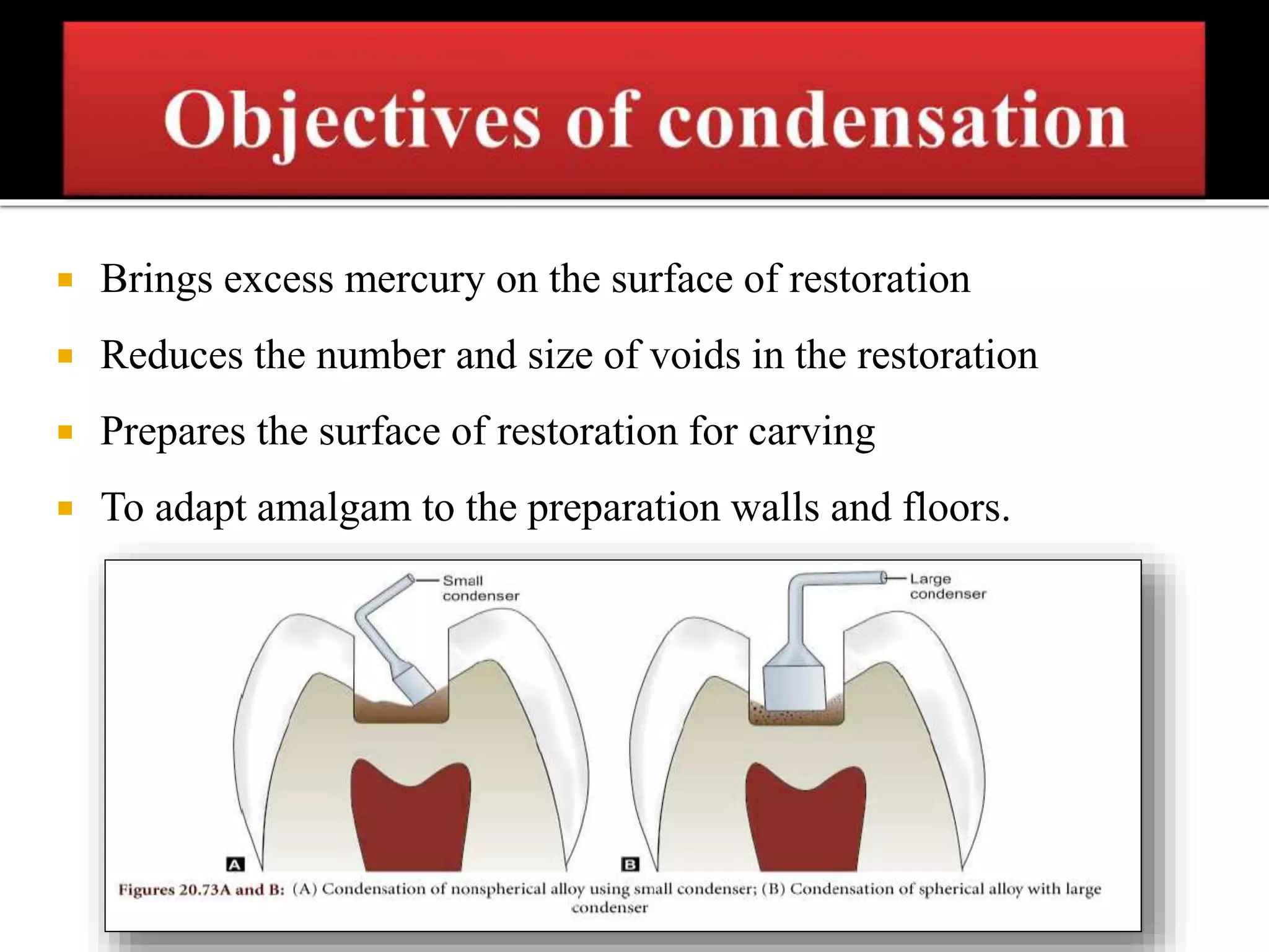 Class 2 amalgam restoration | PPT