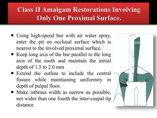 Class 2 amalgam restoration | PPTX