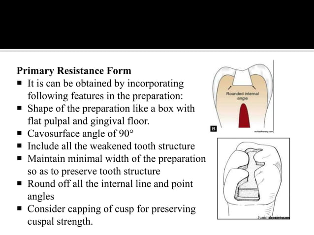 Class 2 amalgam restoration | PPTX