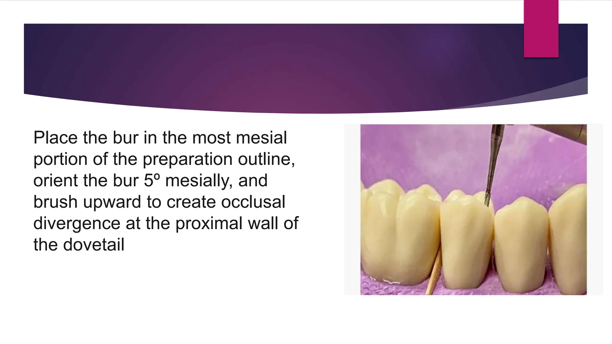 class two amalgam restoration in posterior teeth.pptx