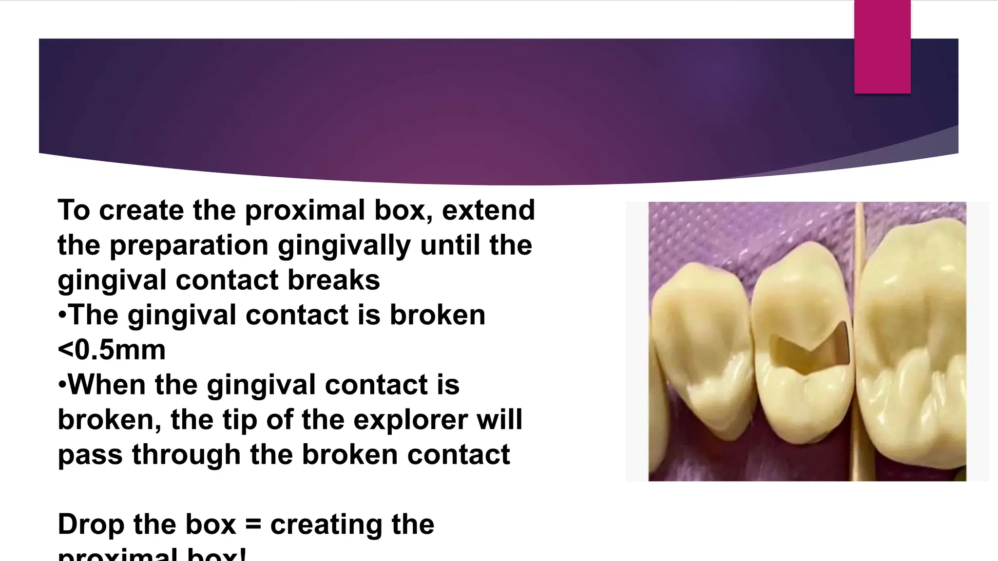 class two amalgam restoration in posterior teeth.pptx