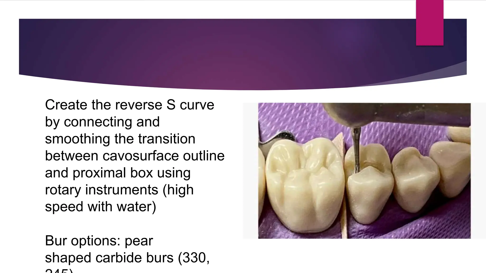 class two amalgam restoration in posterior teeth.pptx