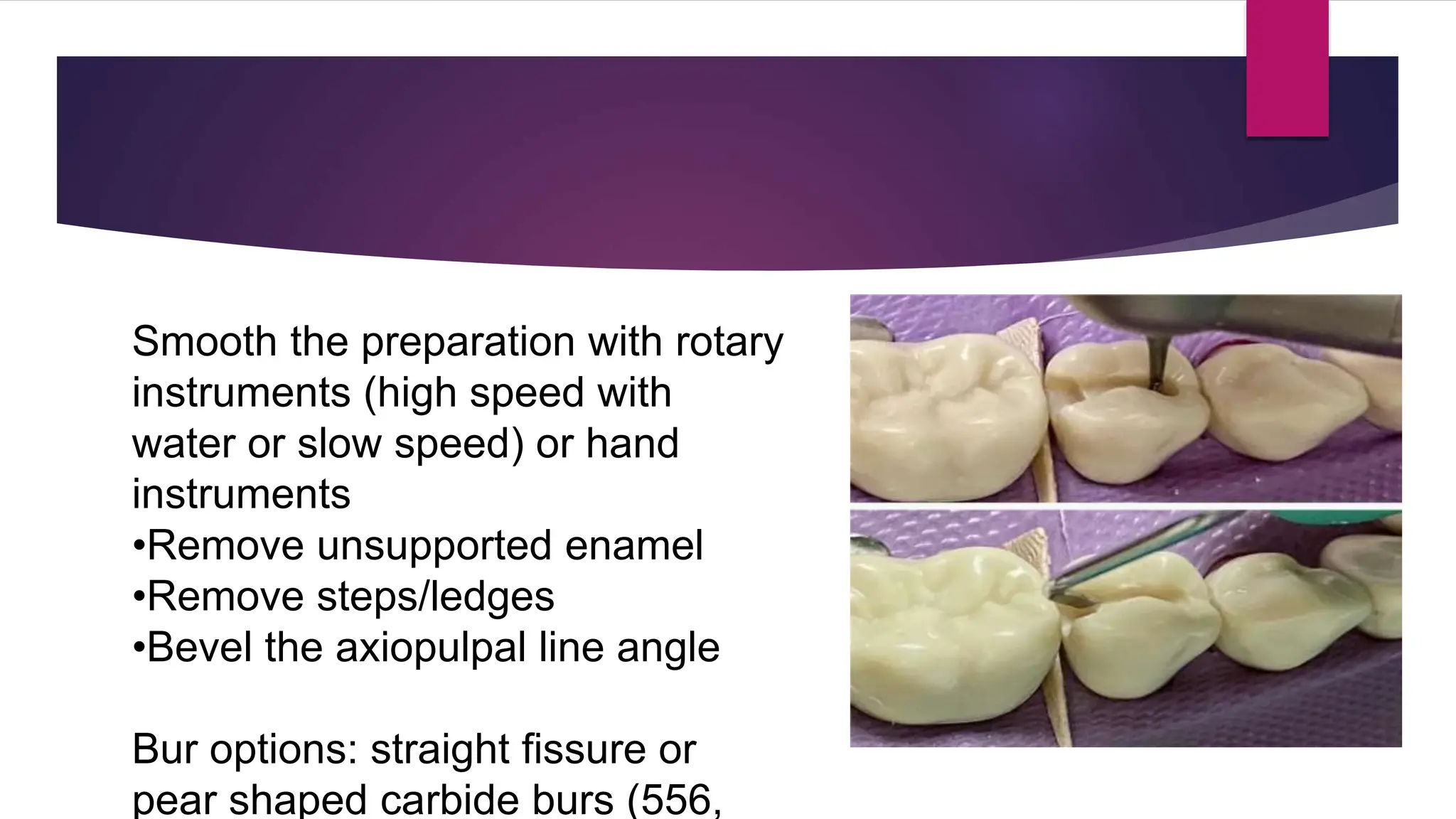 class two amalgam restoration in posterior teeth.pptx