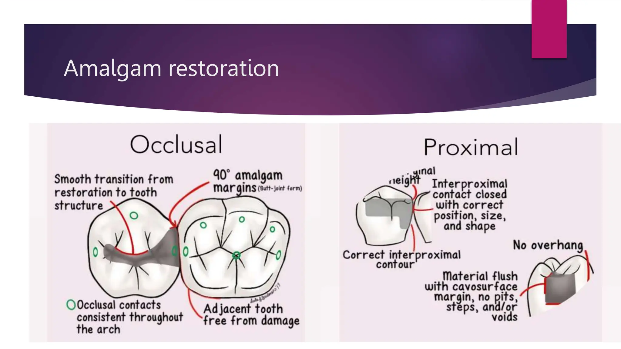 class two amalgam restoration in posterior teeth.pptx