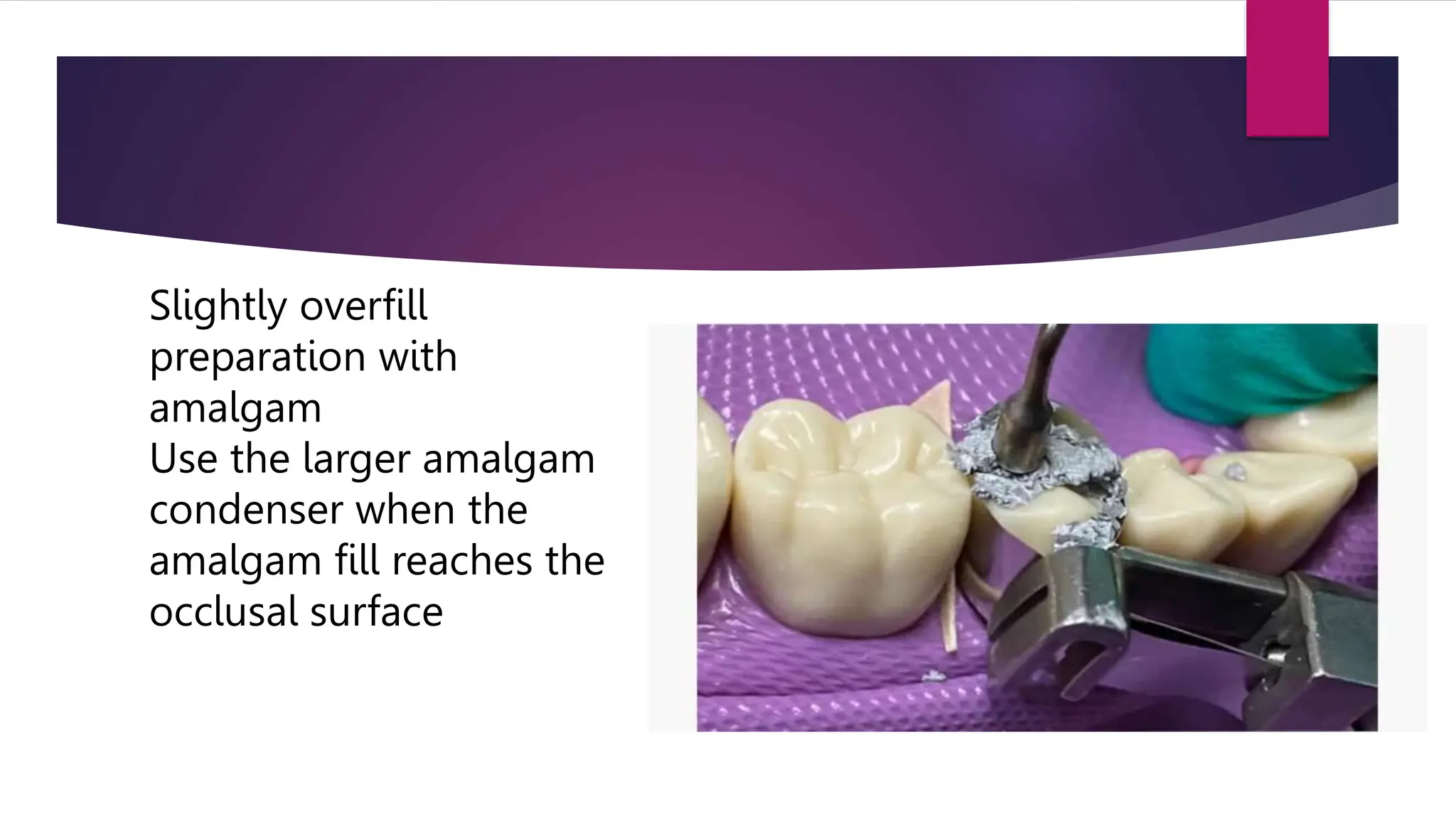 class two amalgam restoration in posterior teeth.pptx