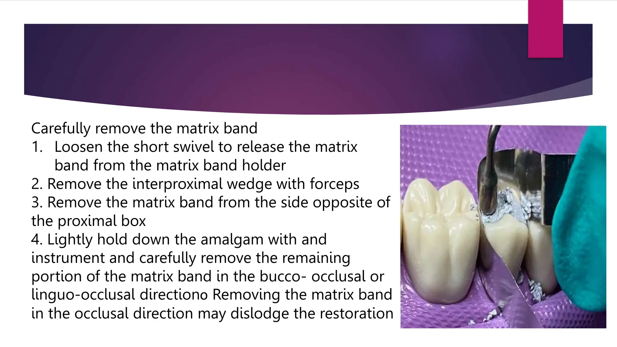 class two amalgam restoration in posterior teeth.pptx