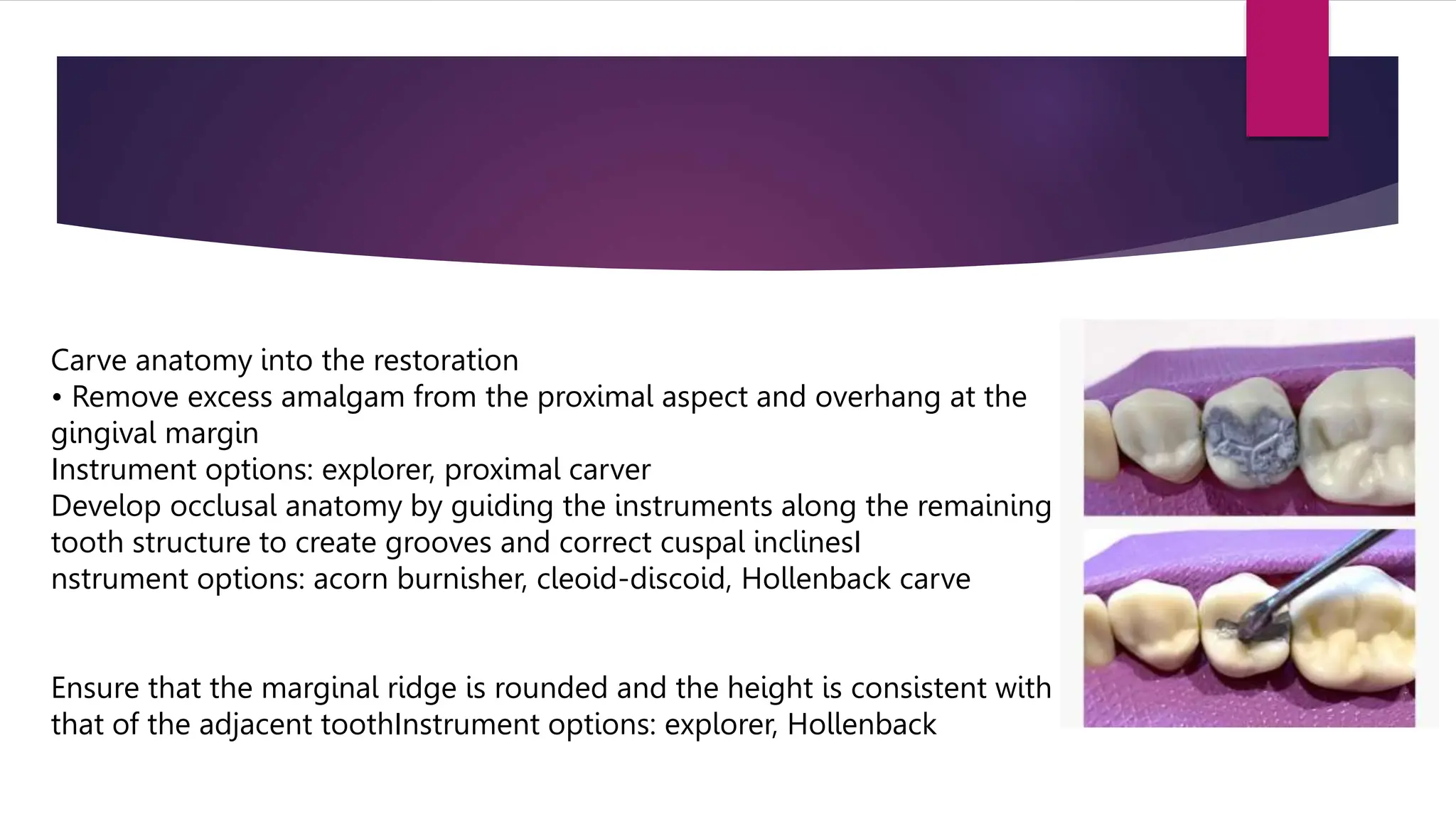 class two amalgam restoration in posterior teeth.pptx