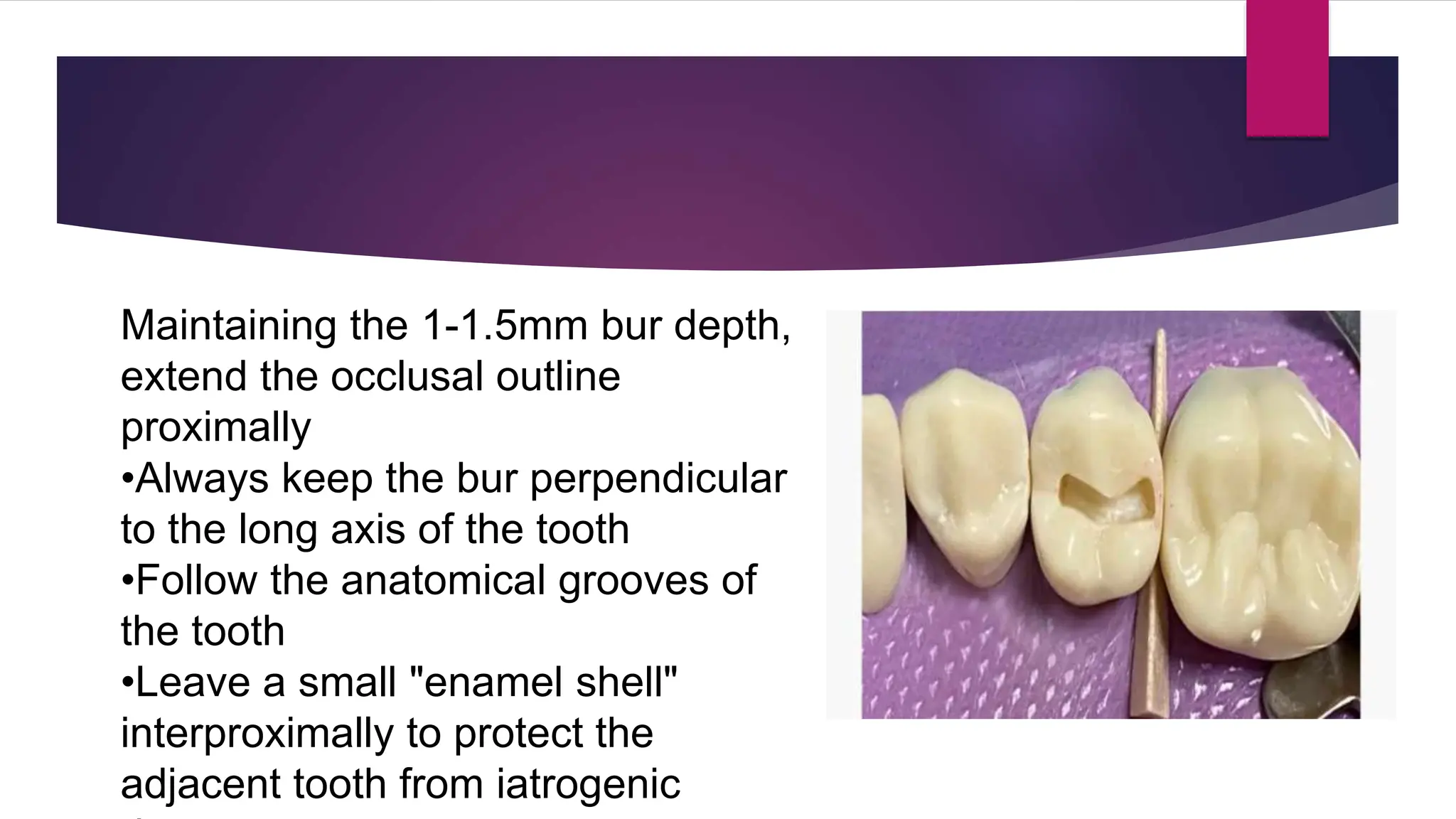 class two amalgam restoration in posterior teeth.pptx