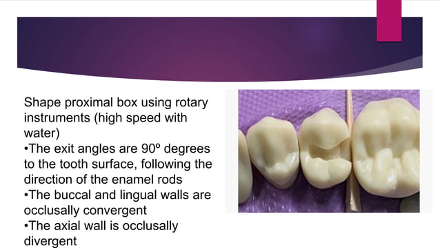 class two amalgam restoration in posterior teeth.pptx