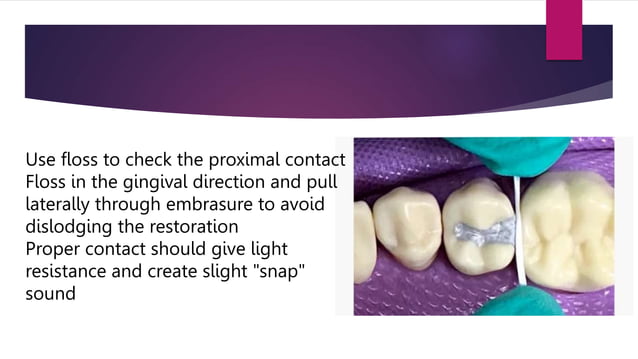 class two amalgam restoration in posterior teeth.pptx