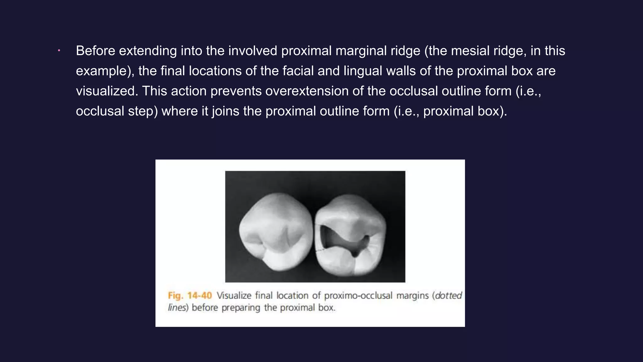 Class 2 cavity amalgam | PPTX