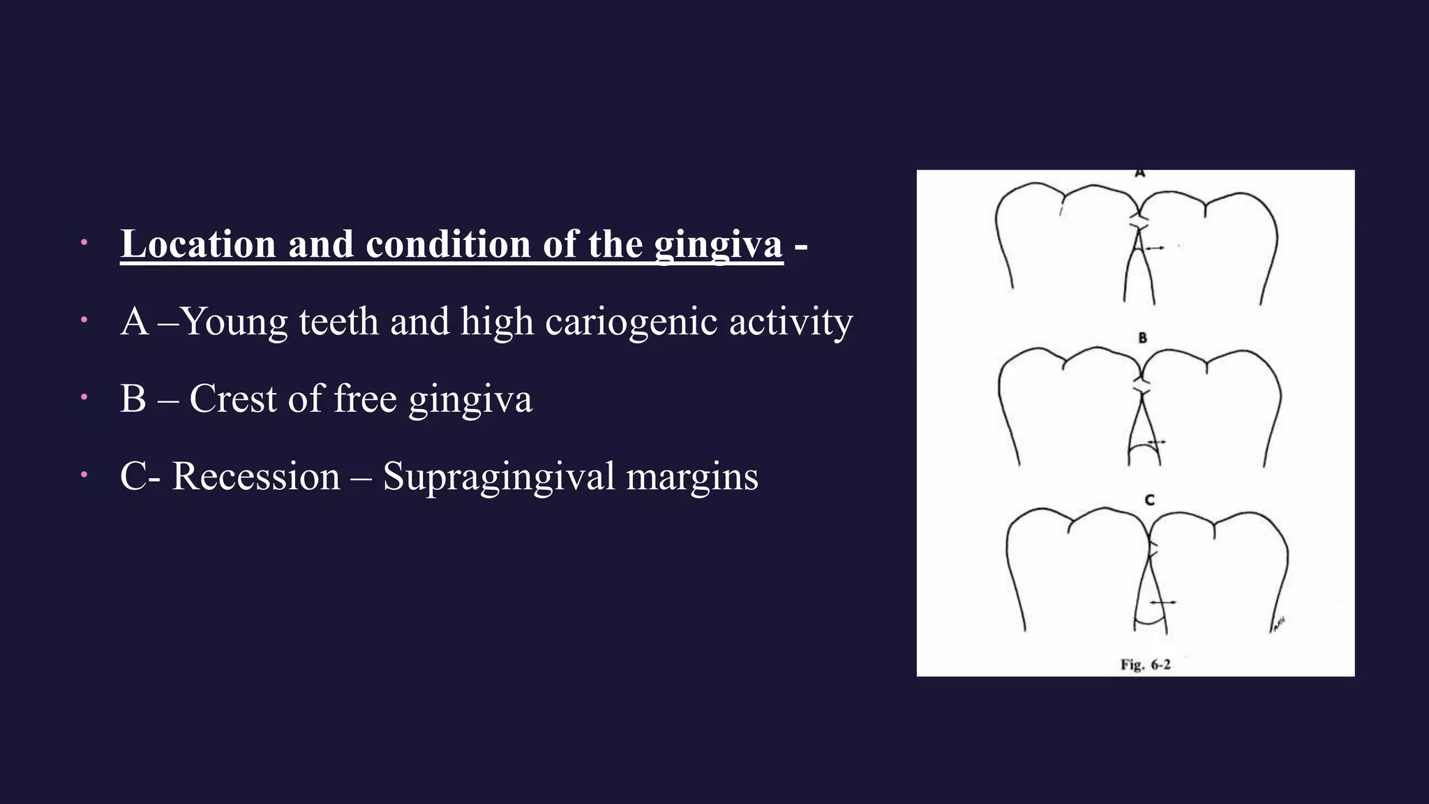 Class 2 cavity amalgam | PPTX