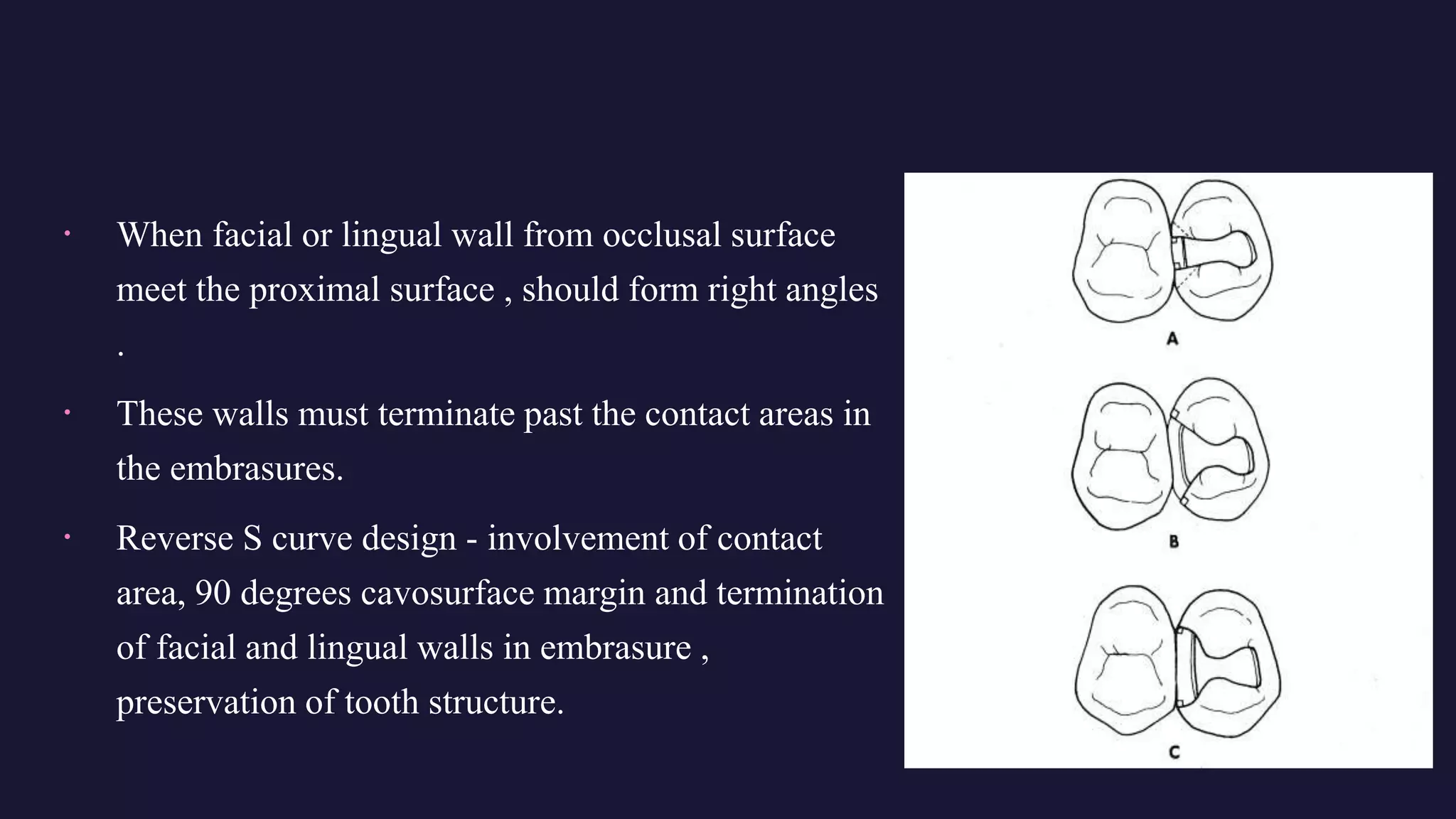 Class 2 cavity amalgam | PPTX