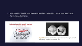 Class 2 cavity amalgam | PPTX